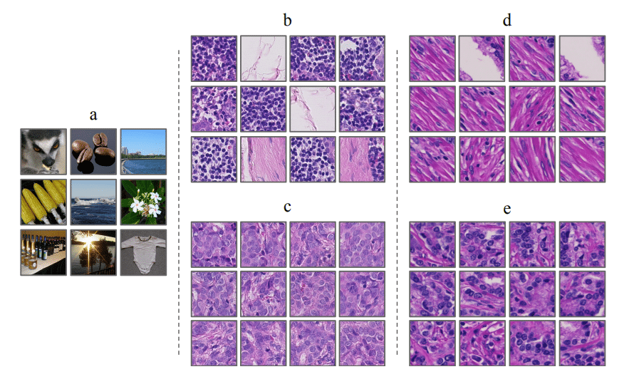 Improving Prostate Cancer Detection with Breast Histopathology Images ...